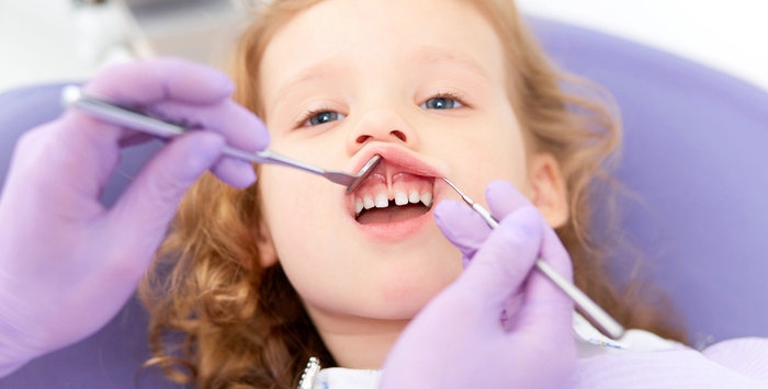 Properly Examine For Tongue Lip Tie Clermont Kids Dentistry